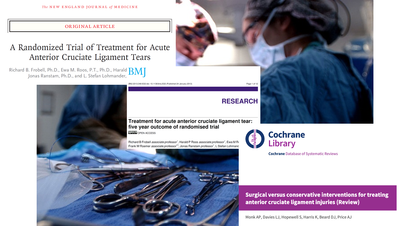 ACL injury - is surgery needed to return to sport? - La Trobe Sport and ...