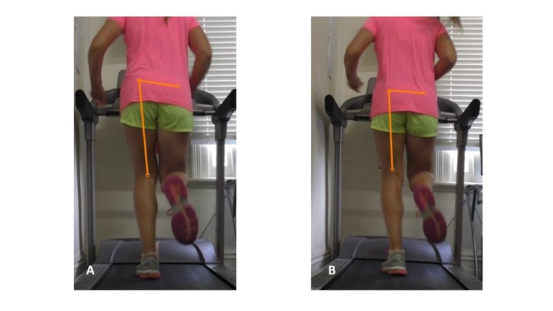 5 tips to help treat your knee cap pain - La Trobe Sport and Exercise ...