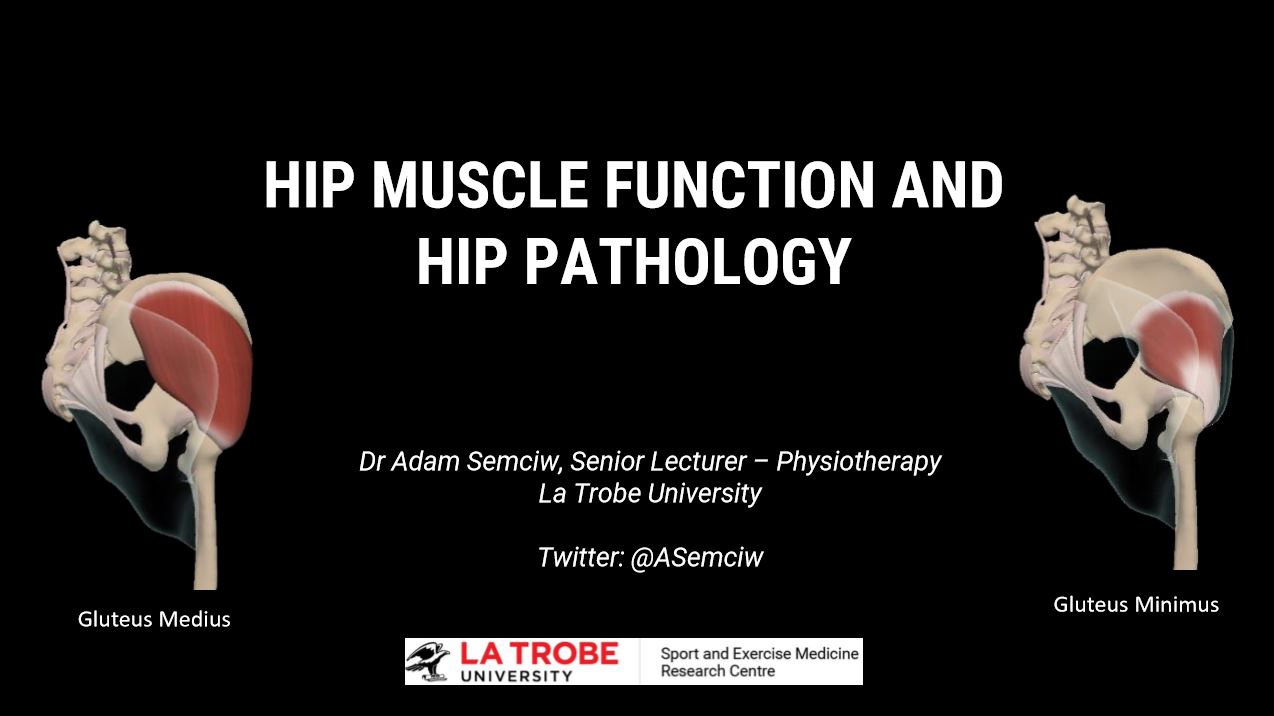 Hip pain in young active adults: Where are we now? - La Trobe Sport and ...